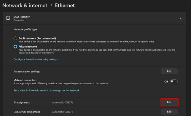Setting up Static IP in Windows 10 and 11 | Support | SaskTel